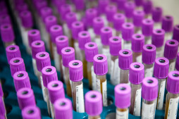 Pathology - St George's University Hospitals NHS Foundation Trust