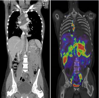 Radiology - St George's University Hospitals NHS Foundation Trust
