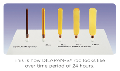 Induction of Labour - St George's University Hospitals NHS Foundation Trust