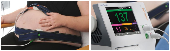 Fetal Monitoring - St George's University Hospitals NHS Foundation Trust